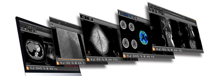 7 Things to Know About PACS Cloud Based System